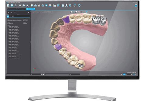 Giải Pháp Phòng Thí Nghiệm Nha Khoa Kỹ Thuật Số Cadcam Và In 3d Cách