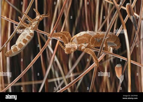 Human Body Lice Coloured Scanning Electron Micrograph Sem Of Body