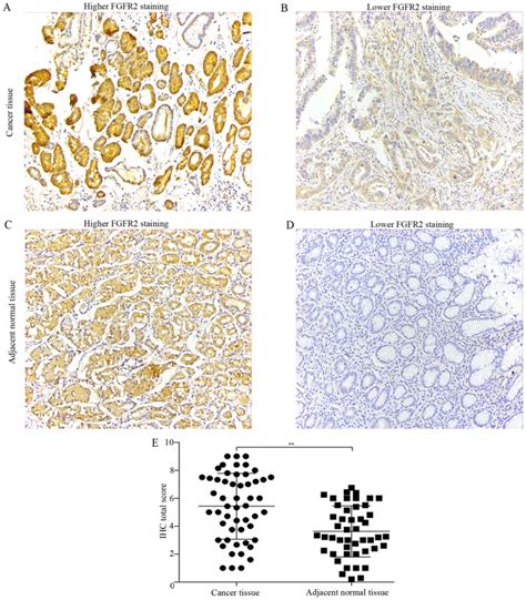 Fgf7fgfr2 Signal Promotes Invasion And Migration In Human Gastric