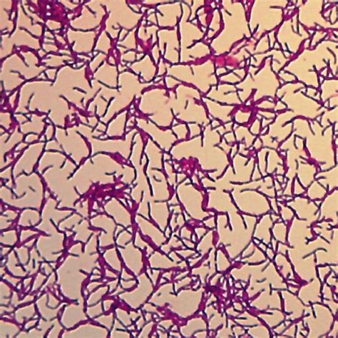 Bacterias Bacilos Portaobjetos Preparados De Microscopía 293970