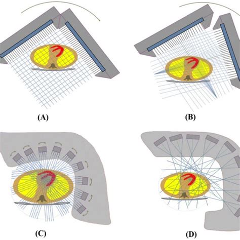 Illustration Of Different Cardiac Spect System Configurations A Illustration Of Different Cardiac Spect System Configurations A