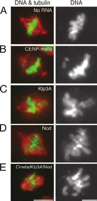 Chromosome Congression Defects After Cenp Meta Cenp E Klp3a