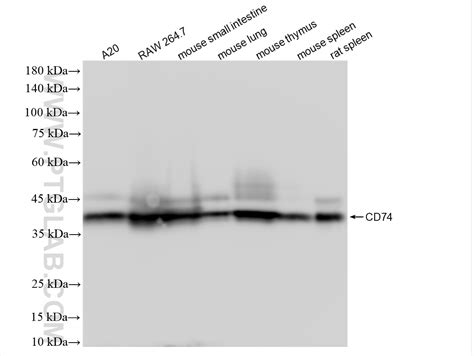 Cd74 Antibody 85802 1 Rr Proteintech