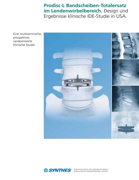 Prodisc L Bandscheiben Totalersatz Im