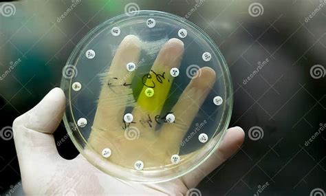 Antimicrobial Susceptibility Testing In Culture Plate Drug Sensitivity
