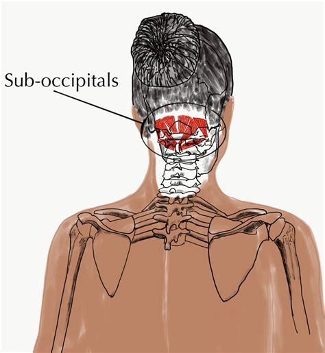 Suboccipitals — The Bodywork Institute