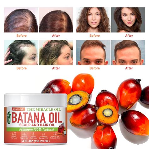 11 Best Hair Oils For Growth Starting At 9 Tested And Reviewed