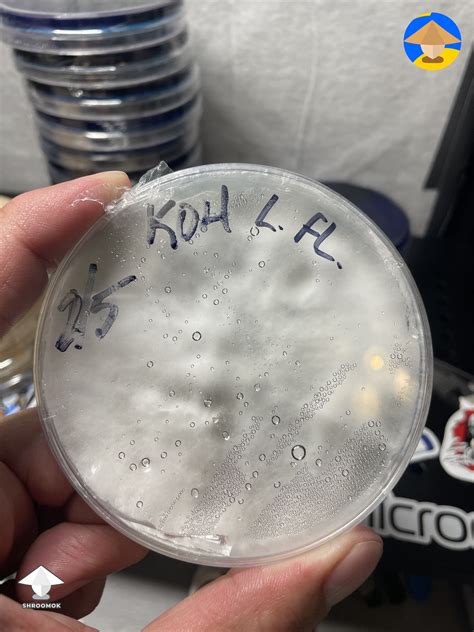 How Long Do Agar Plates Last At Tracy Macias Blog