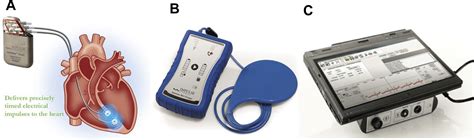 Cardiac Resynchronization Therapy And Cardiac Contractility Modulation