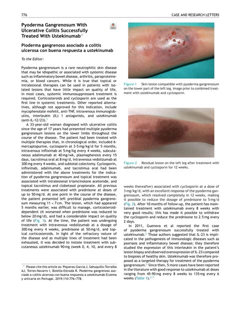 Wound Care For Pyoderma Gangrenosum At Susan Lebrun Blog