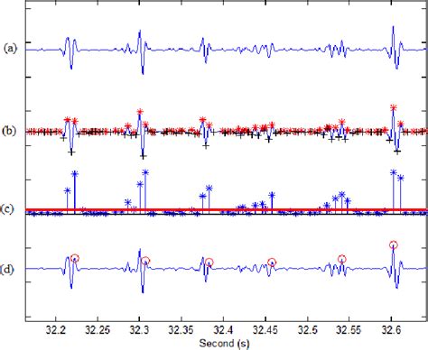 Figure 1 From Amplitude Based Beat Detection For Atrial Fibrillation In Pacemaker Semantic Scholar