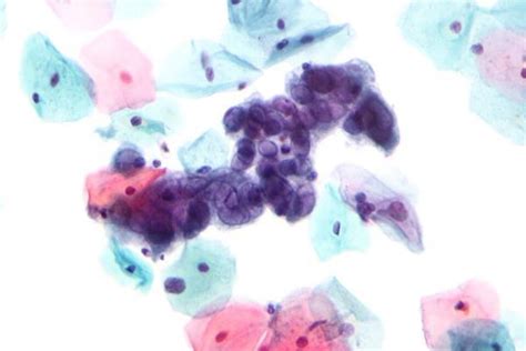 Scientists Explore How Viruses Replicate And Infect News The