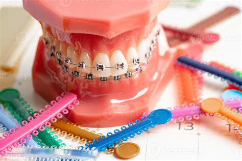 Ortodoncia Ligaduras Anillos Y Corbatas Elástico Caucho Bandas En