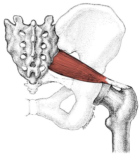 Sciatic Nerve Pain Relief Begs For Good Posture