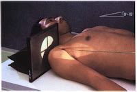 Tangential Projection Intertubercular Bicipital Groove Shoulder