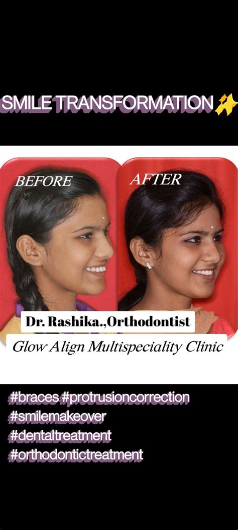 Dr Rashika P Posted On Linkedin
