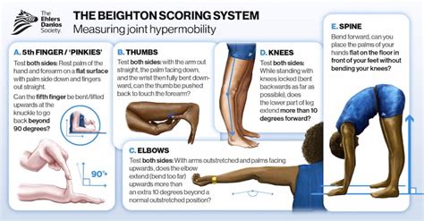 Eds Ehlers Danlos Syndrome Exercise Artofit