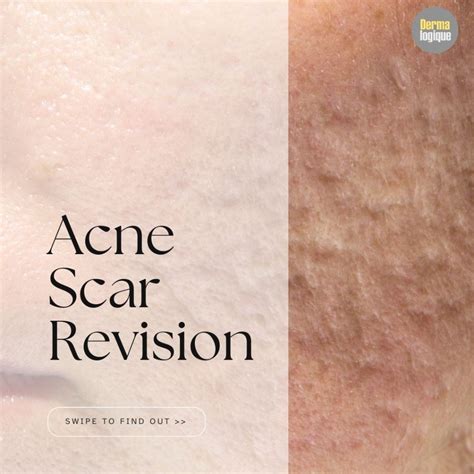 Dermalogique Your Best Skin Begins Here
