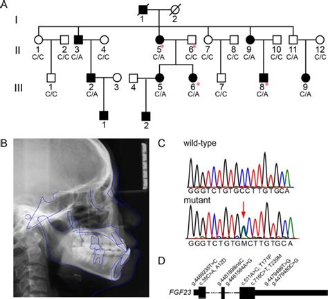Identification Of A Mutation In Fgf23 Involved In Mandibular