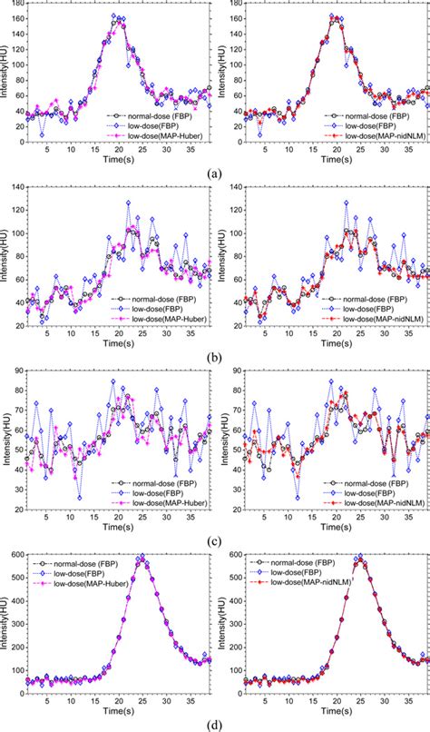 Iterative Image Reconstruction For Cerebral Perfusion Ct Using A Pre Contrast Scan Induced Edge
