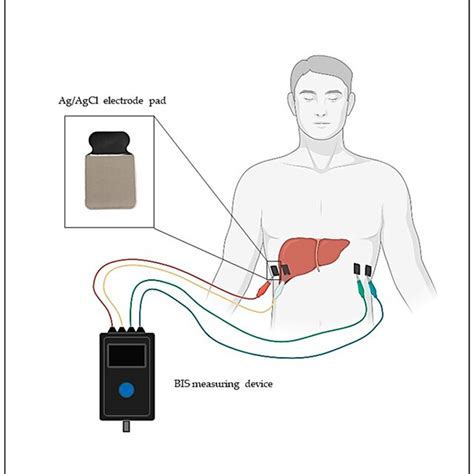 The Schematic Of The Self Developed Clinical Bis Measurement Principle