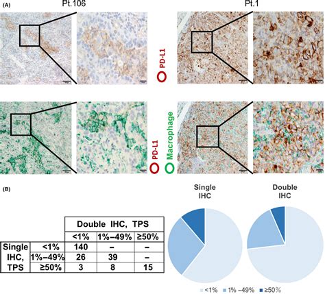 Accurate Expression Of Pd‐l1l2 In Lung Adenocarcinoma Cells A