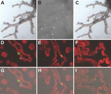 Transduction Of Bronchiolar Airway Epithelial Cells After In Vivo