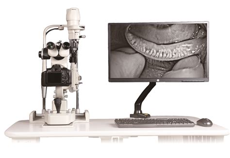 Slit Lamp Eye