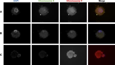 Examples Of Fish Images Blastomeres Were Analysed By Fish With Probes