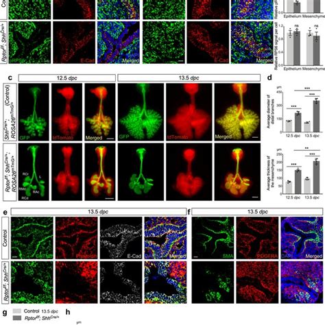 A Model Of Lung Branching And Saccule Formation A Schematic Diagram Of