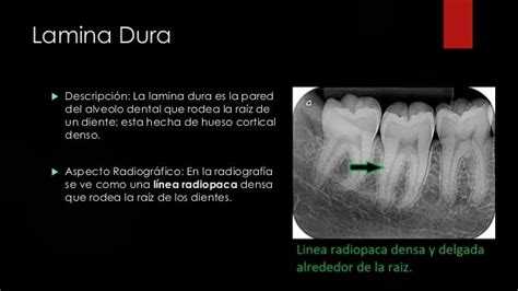 Radiologia Dental Haring Jansen Capitulo 26