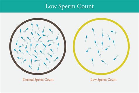 Sperm Count Vector Art Icons And Graphics For Free Download