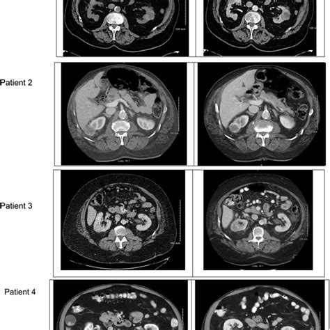 Pretreatment And Post Treatment Imaging Download Scientific Diagram