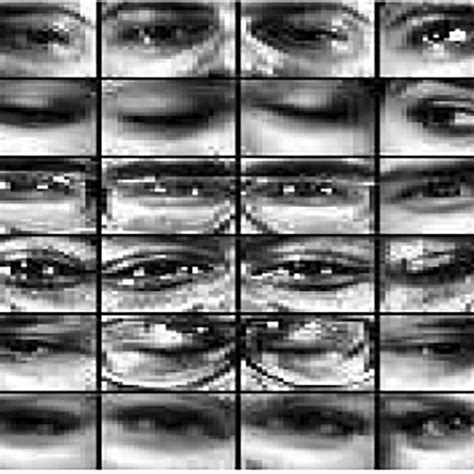 Eye Part Full Extraction Using Svm Approach 23 Download Scientific Diagram