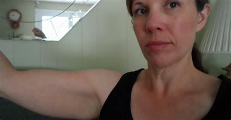 Weight Loss And Excess Skin PS Fitness