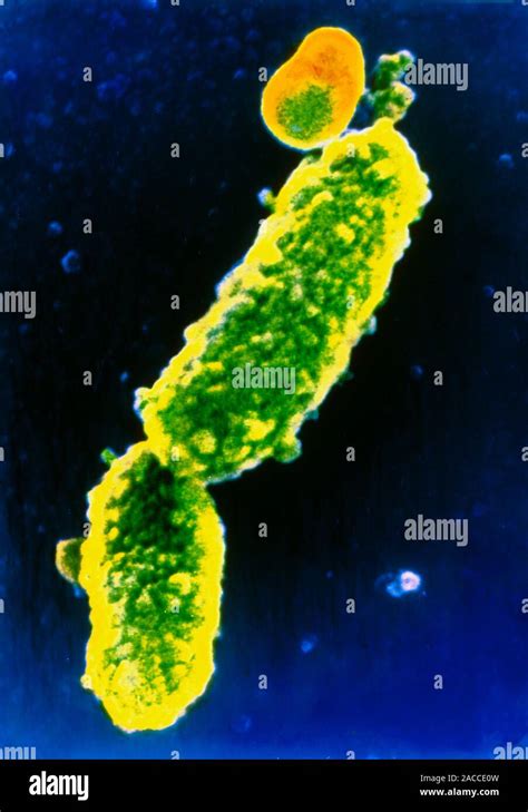 False Colour Scanning Electron Micrograph Sem Of The Whooping Cough Bacteria Bordetella