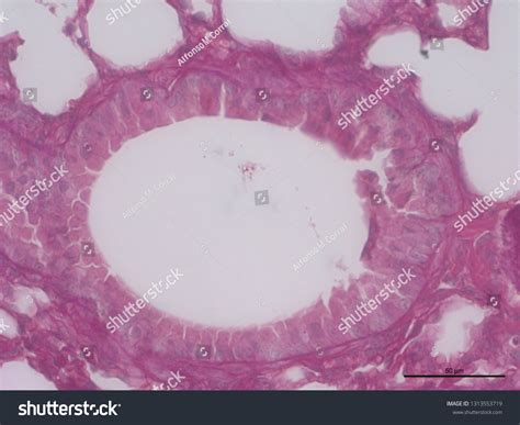 Lung Slide Bronchiole Lung Human X01 800px 