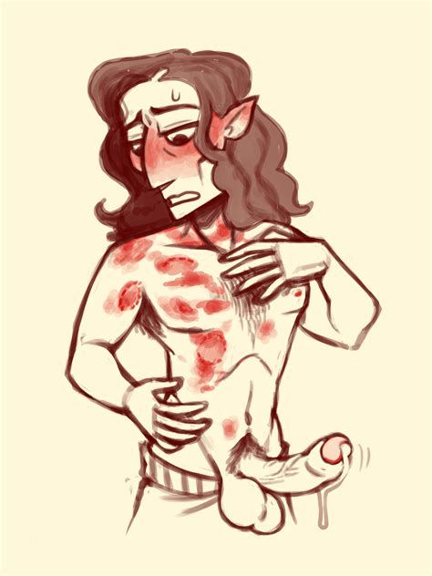 Rule 34 Bitemarks Bruise Bruised Hickey Hickeys On Neck Oc Original Character Precum Sketch