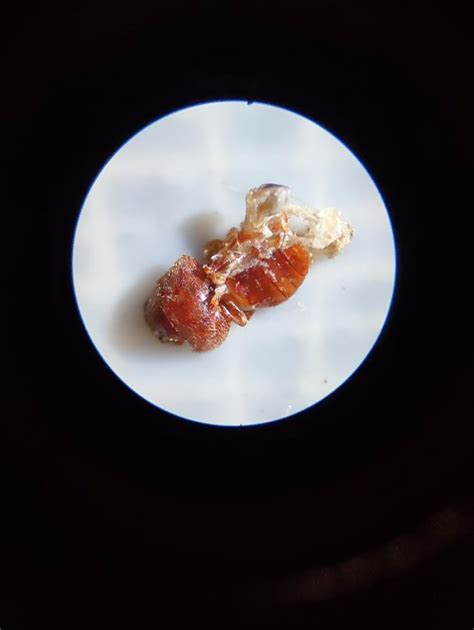 Help Identify Squished Bug Under A Microscope R Bedbugs