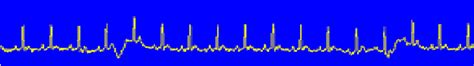 4 Electrocardiogram Ecg Signal Of A Beating Normal Rat Heart