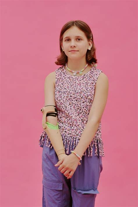 Teen Girl With Disability Portrait Stock Image Image Of Teenager