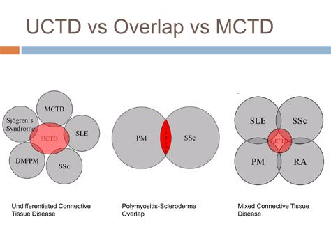 Mixed Connective Tissue Disorder Pptx
