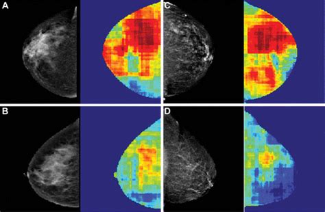 Beyond Breast Density Risk Measures For Breast Cancer In Multiple Imaging Modalities Radiology