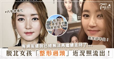 清純樣貌不再？！脫北女孩朴研美整形整到變了樣！澎澎臉頰＋厚唇，超真實「近況照」嚇壞一群網友！ 女生集合 Tagsis