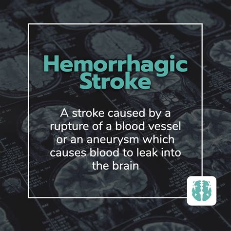 Stroke 101 What Everyone Needs To Know On World Stroke Day