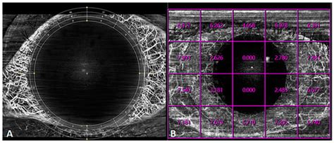 Diagnostics Special Issue Whats New In Retinal Imaging