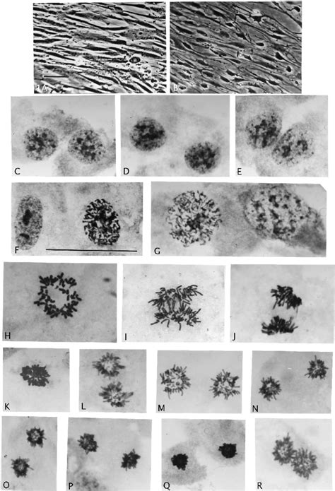 Nuclear Size And Mitosis Of F Dpcs Compared To Normal Fibroblasts A Download Scientific