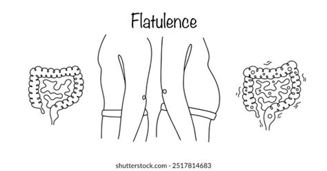 People With Flatulence Hơn 456 Hình Minh Họa Và Hình Vẽ Có Sẵn Miễn