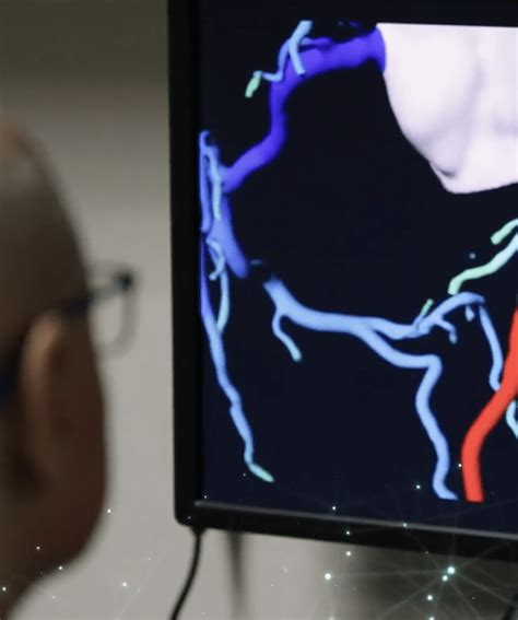 Vcast Medicalgorithmics