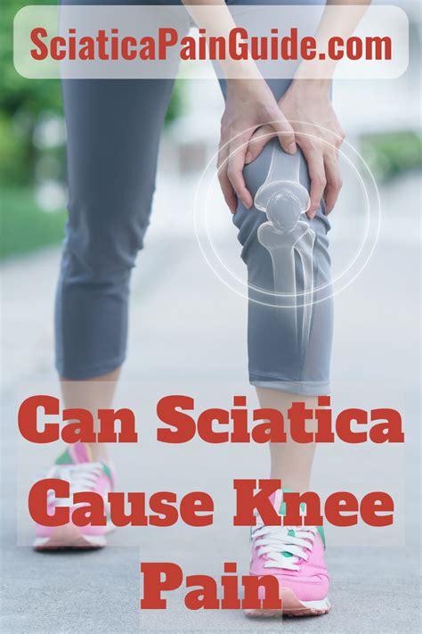 Can Sciatica Cause Knee Pain In 2025 Sciatica Knee Pain Chronic